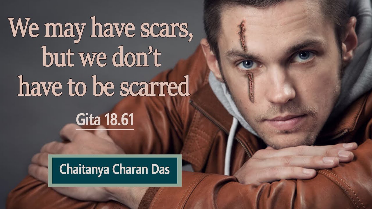 We may have scars, but we don’t have to be scarred. - HARE KRSNA TV ...